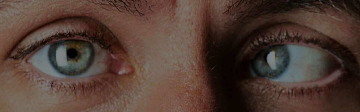 Strabismus Treatment Delhi, Squint, Misaligned Eyes Treatment East Delhi